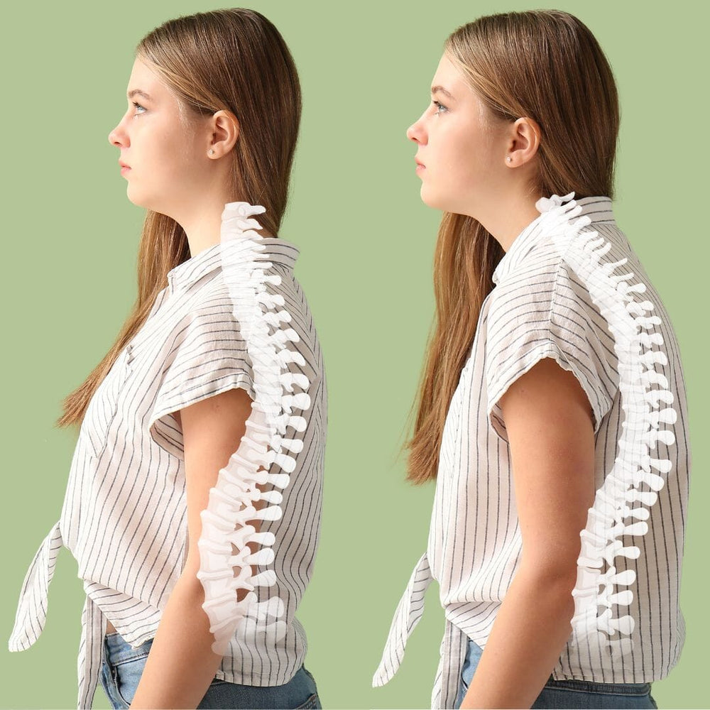 The Role of Alignmed Posture Garments in a Physiotherapy or Posture Re